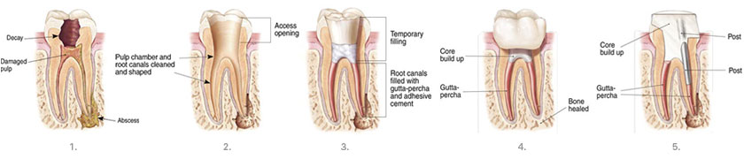 Home - Billis Endodontics